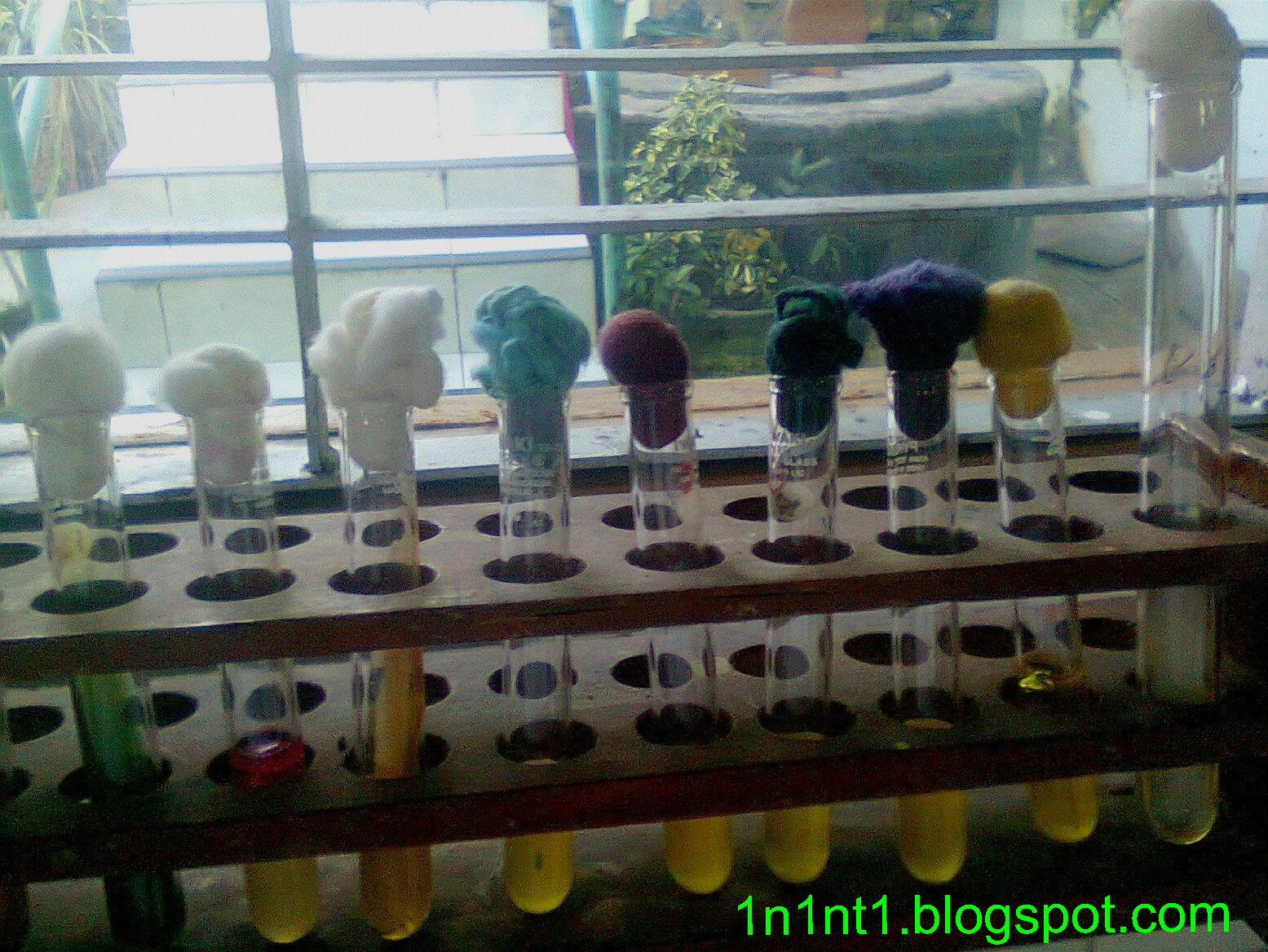 Kultur dan Hasil Uji Biokimia Bakteri Gram Negatif ~ Analis Kesehatan ...