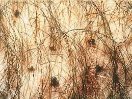 Pulitissima: LE PIATTOLE