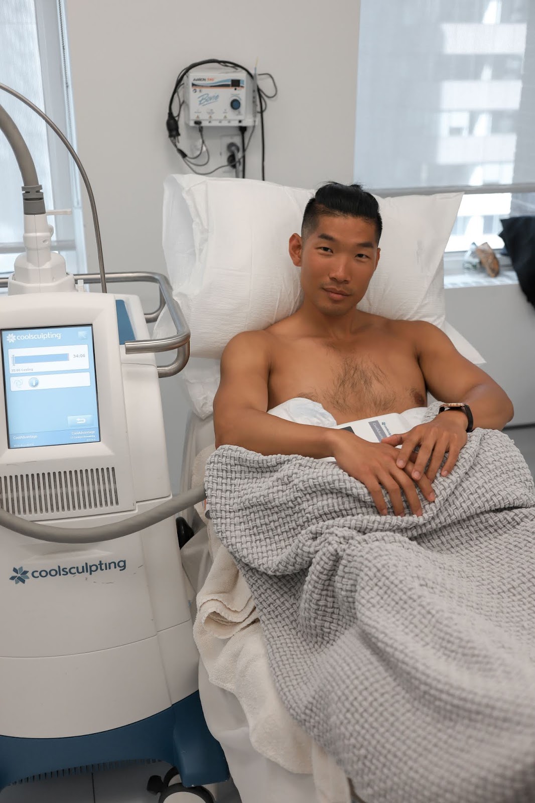 My CoolSculpting® Experience — LEVITATE STYLE