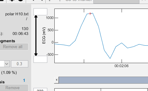 Muscle Oxygen Training: Polar H10 ECG tracing - a short how to guide