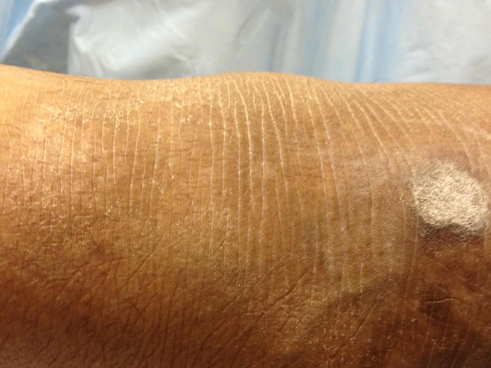 EL RINCÓN DE LA MEDICINA INTERNA. juanpedromacaluso@yahoo.com.ar ...