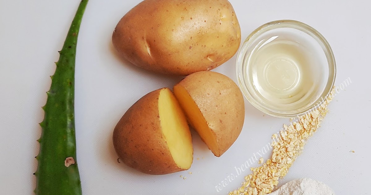 Home Remedies For Acne With Potato