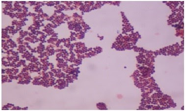 Praktikum Pewarnaan Gram