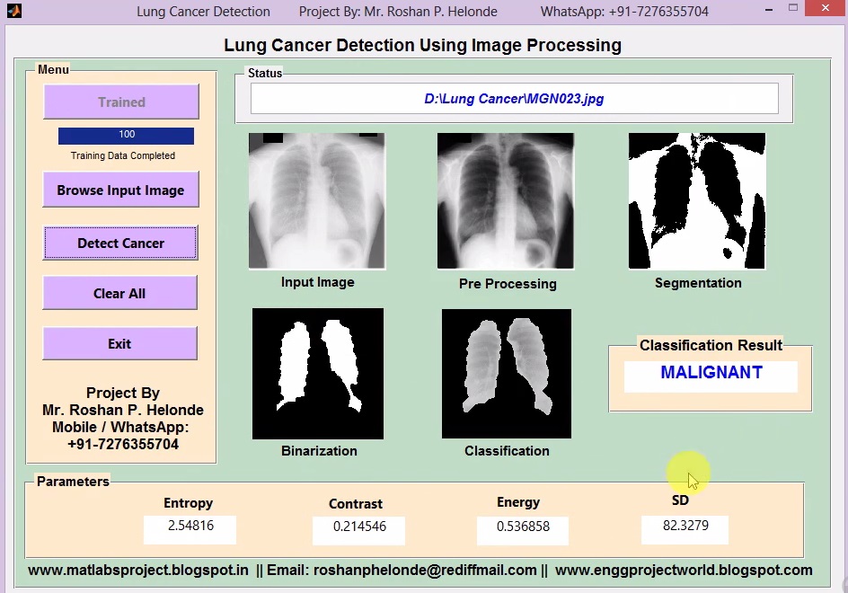 Matlab Code For Lung Cancer Detection Using Image Processing ~ Matlabs Code