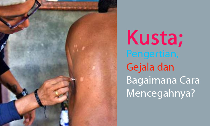 Kusta; Pengertian, Gejala dan Bagaimana Cara Mencegahnya? - Kopiah Putih