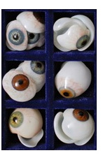 Miranza IOA: MICROFTALMIA