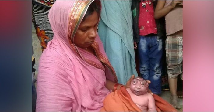 9UNews: 'ALIEN' Baby Born In INDIA Her Mother Shocked }