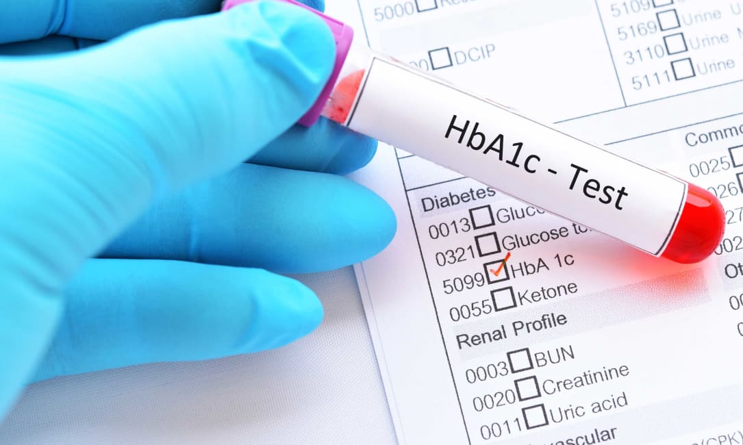 A1C (HbA1c) test ဆီးချိုအတွက်