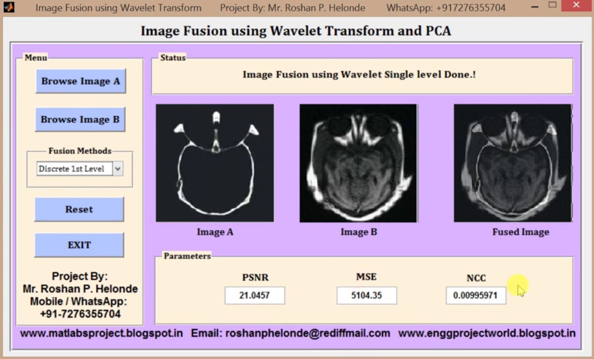 Matlab Code For Image Fusion Using Wavelet Transform And Pca ~ Matlab Projects 9798