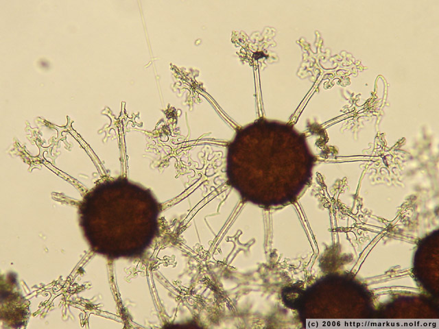 FITOPATOLOGIA GERAL UFPR 2018: Aula prática 3- Estruturas de fungos e ...