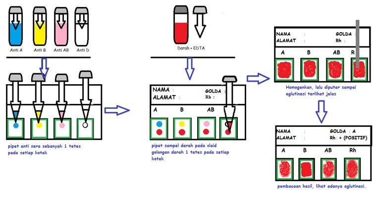 pemeriksaan golongan darah metode direct dan indirect ~ IREN`S HOME