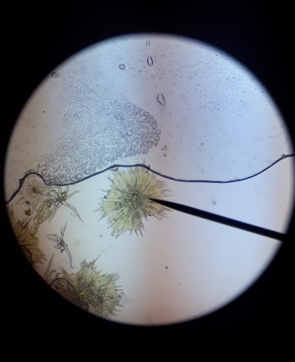 Trikoma pada Daun Durian