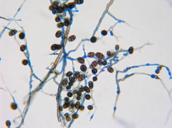 Fun With Microbiology (What's Buggin' You?): Pithomyces species