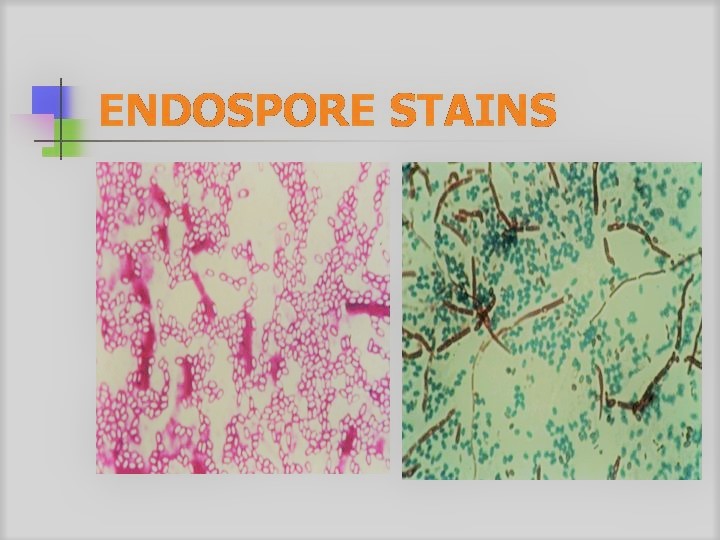 HicksMicro COURTESY Learning AID!: STAINING PROBLEMS