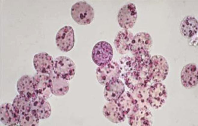 FICHERO DE HEMATOLOGIA: CUERPOS DE HEINZ