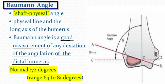 Baumann Angle