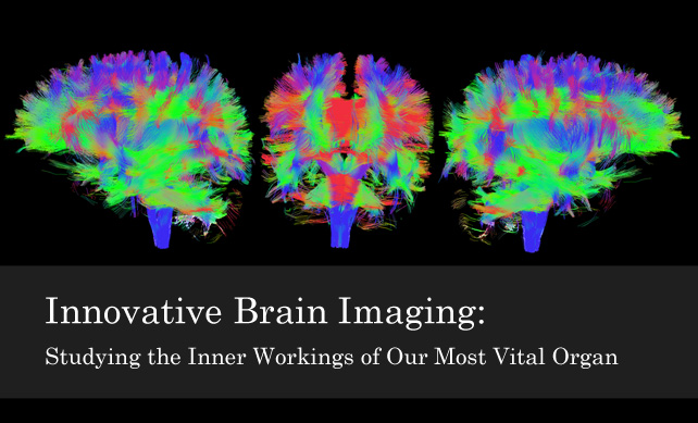 AP Psychology @AHS: Notes - Unit 2 - BIological Bases of Behavior