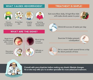 9 Facts about Hemorrhoids