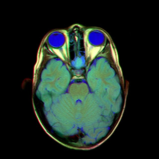 Nevit's blog: Color MRI of the Brain