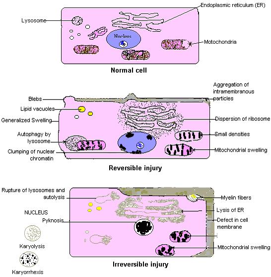 STUDENT'S MEDICARE: Cell Injury