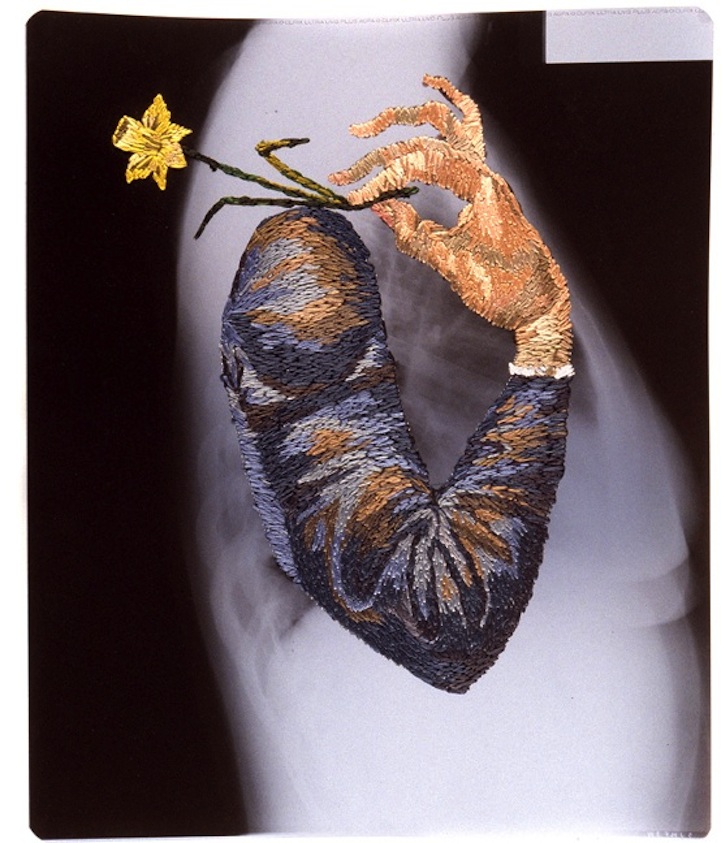 VM designblogg: Οι Κεντημένες Ακτινογραφίες του Matthew Cox