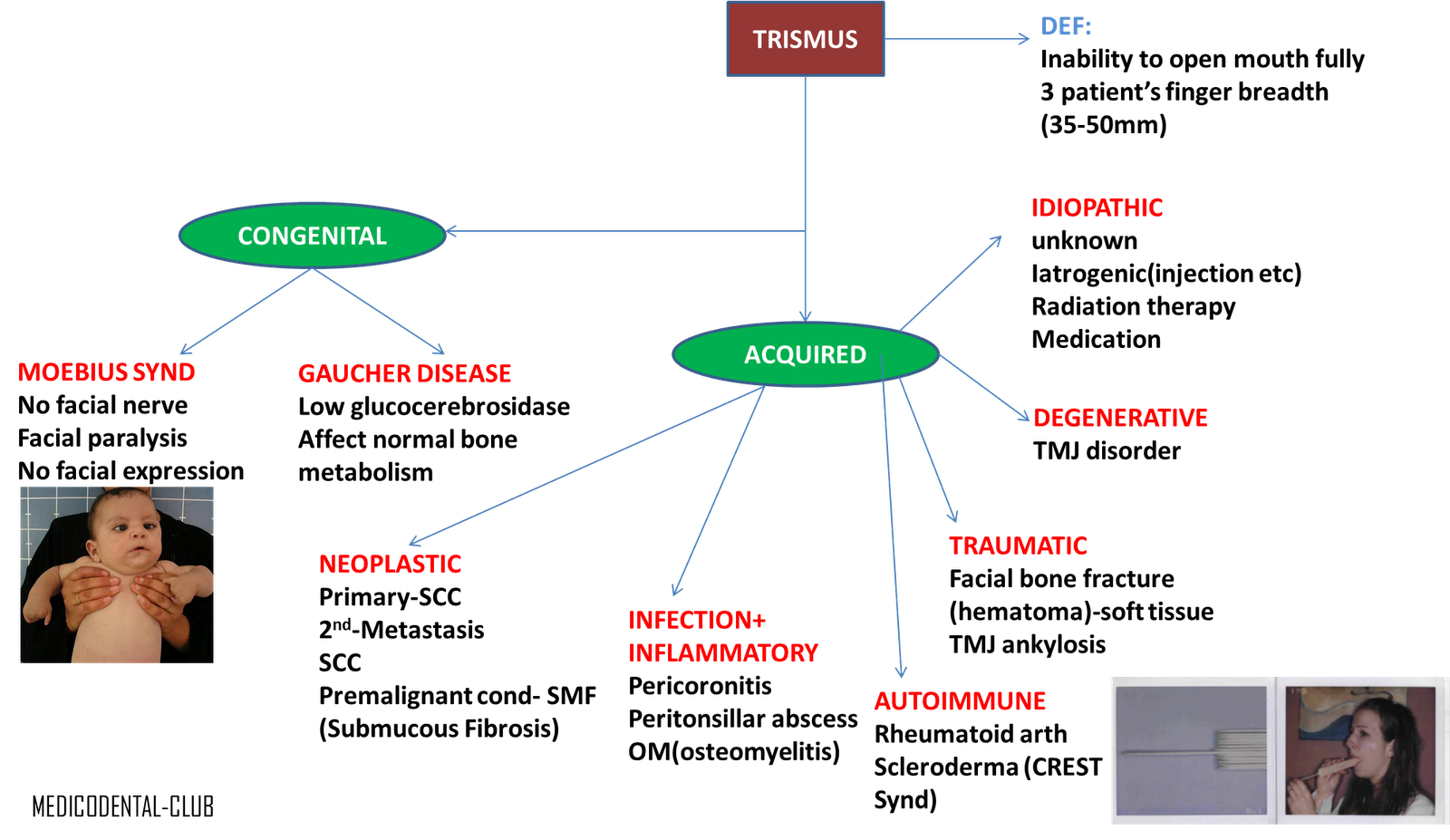 MEDICODENTAL: TRISMUS