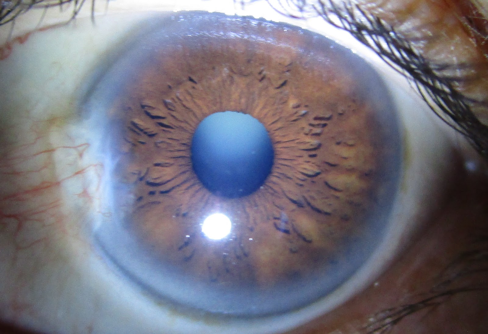 A COR DAS IRIS E SEU SIGNIFICADO (II)