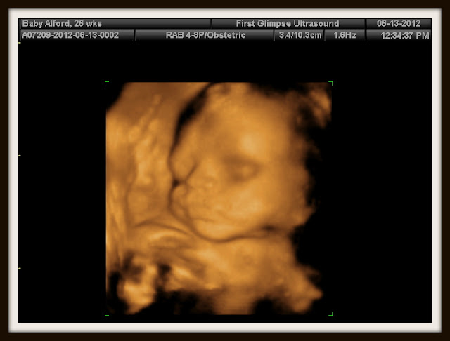 Us + Two: 25 Weeks 6 Days- 3D Ultrasound