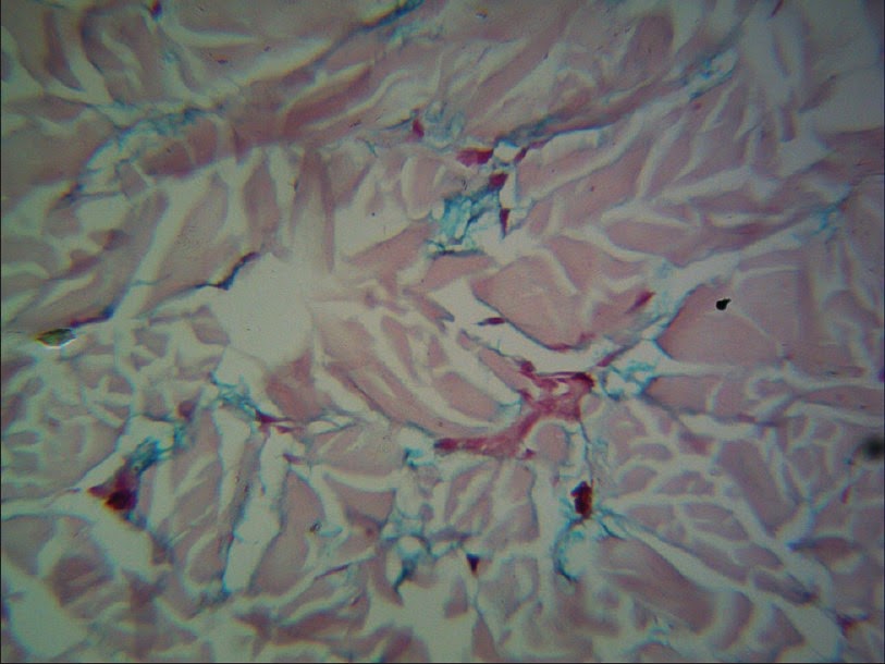 EL RINCÓN DE LA MEDICINA INTERNA. juanpedromacaluso@yahoo.com.ar: 15 ...