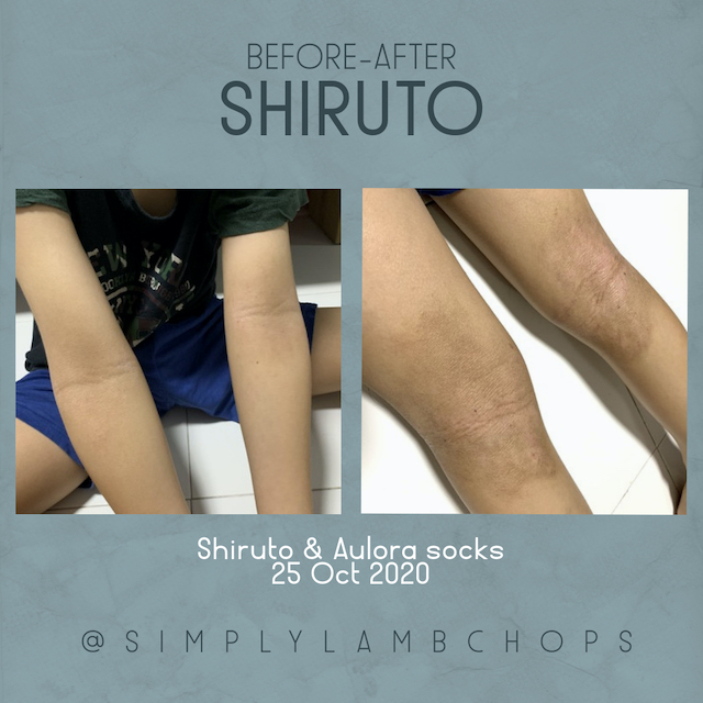 [Review] How Shiruto and Aulora Kodenshi socks helped my son's eczema ...