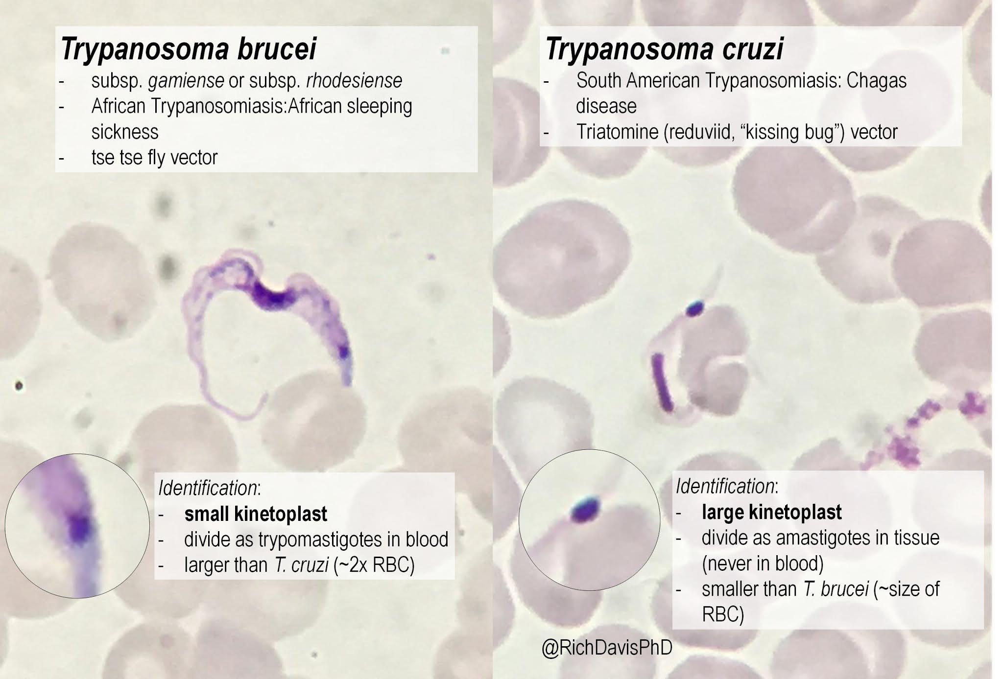 American trypanosomiasis Vs African trypanosomiasis