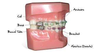 bracket murah berkualitas: CONTOH PEMASANGAN BRACKET BESERTA ...