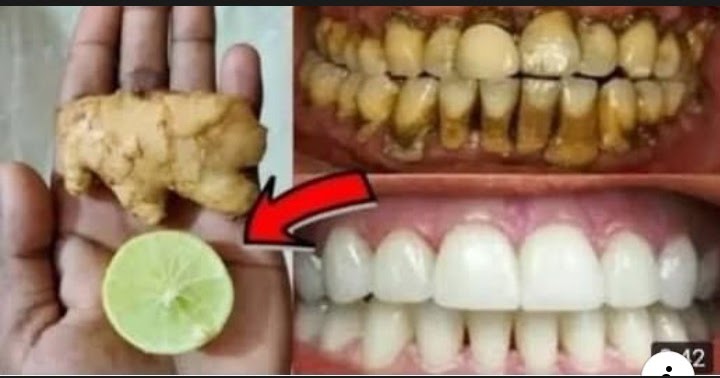 Video:This is how I cleaned my teeth with Ginger and Lime. Clean yours ...