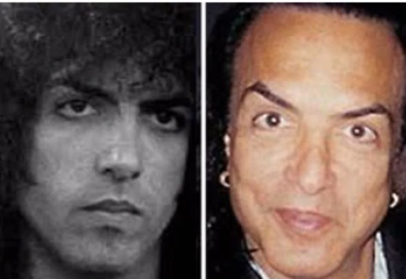 Paul Stanley Plastic Surgery