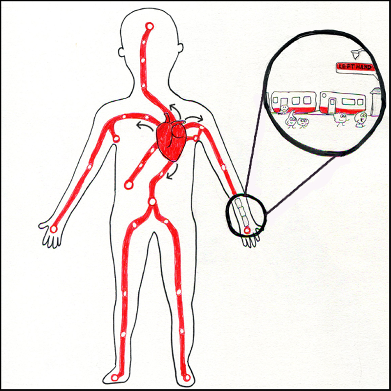 Ingrijire limfedem & lipedem : Limfedemul pe înţelesul tuturor