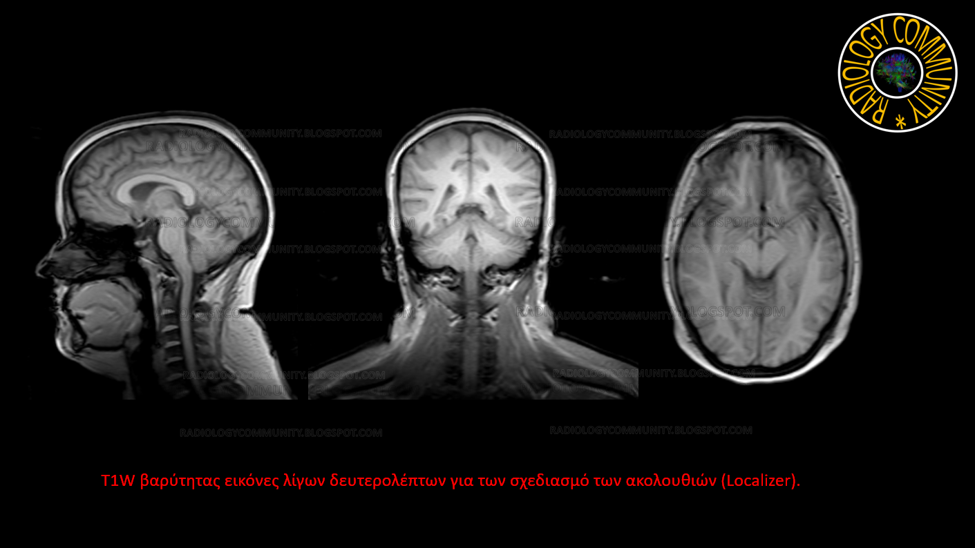 Radiology Community: Μαγνητική Τομογραφία Εγκεφάλου (Brain MRI): Από ...