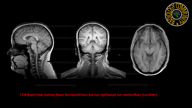 Radiology Community: Μαγνητική Τομογραφία Εγκεφάλου (Brain MRI): Από ...