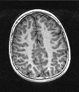 The Playful Spirit: Functional MRI... cool brain mapping!