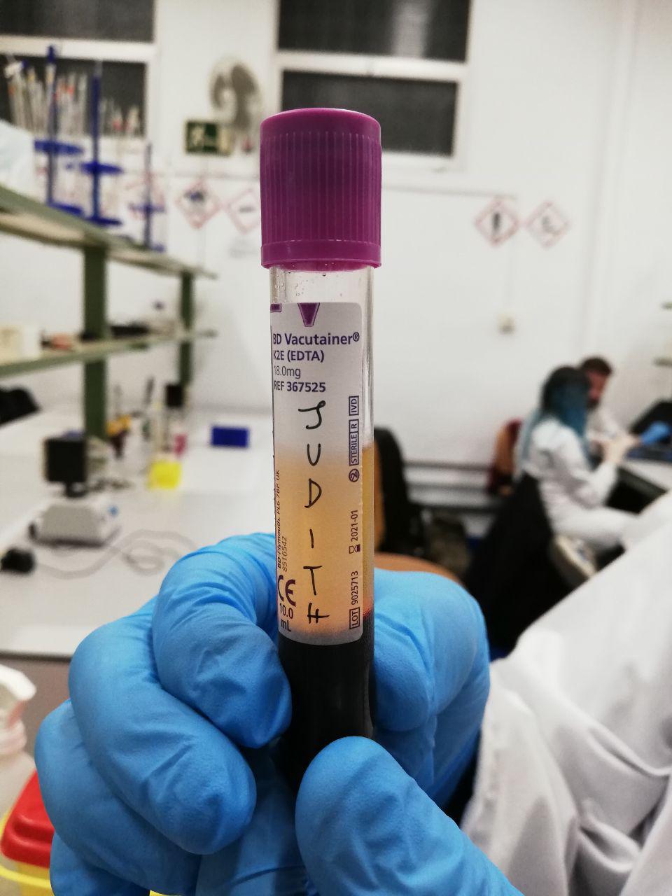 EXTRACCIÓN ADN GENÓMICO A PARTIR DE LOS LINFOCITOS DE LA SANGRE. (27 de ...