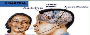 TRANSTORNOS DE LENGUAJE Y COMUNICACIÓN: enero 2014