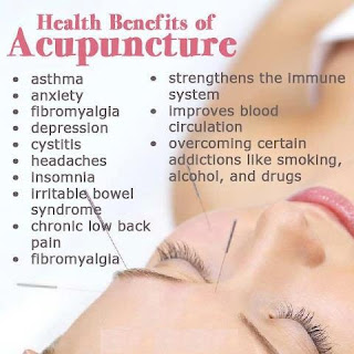 What are the possible side effects and benefit of acupuncture? - Khong ...