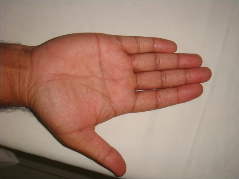 Unusual (Rare Lines & Shapes) Palm Image | INDIAN PALMISTRY ~ INDIAN ...