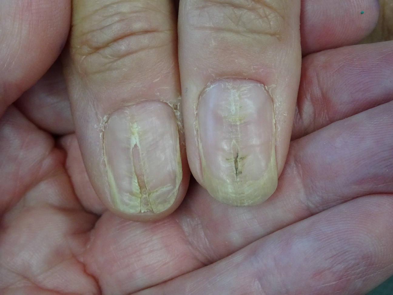 Consultations in Dermatology