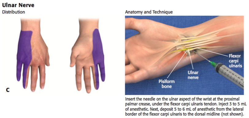 EM Didactic: Wrist Block (Landmark Technique)