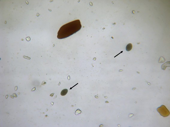 Fun With Microbiology (What's Buggin' You?): Diphyllobothrium latum ...