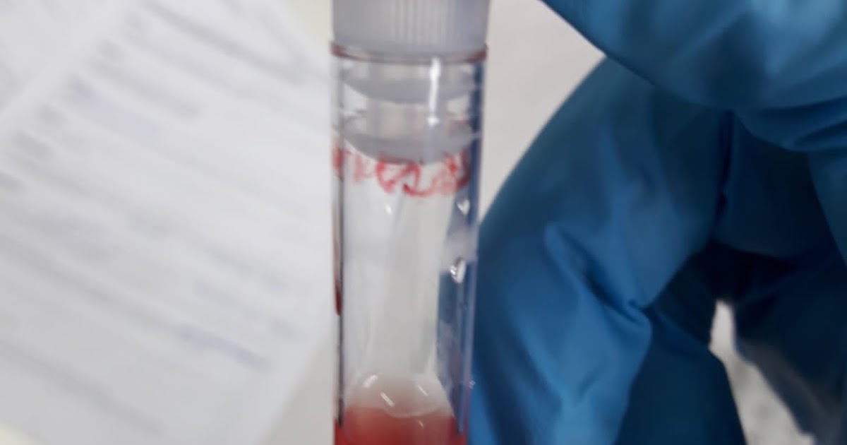 HEMATOLOGÍA: PRÁCTICA 10: DETERMINACIÓN DE COOMBS DIRECTO EN TUBO