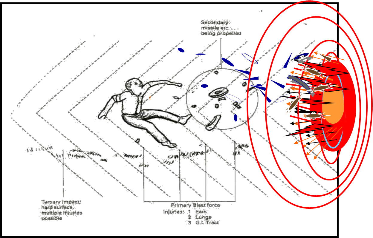 Cinematica de Trauma ATROPELLO, Explosion, Peatones – MED-TAC ...