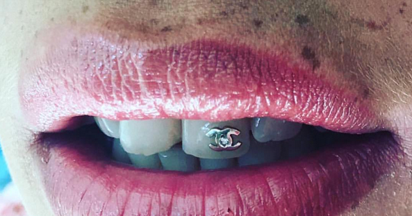 Fittings Division : 90's Tooth Gems