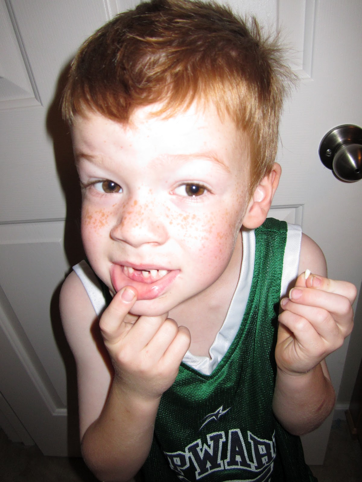 Live In The Moment: Ben Lost His First Tooth