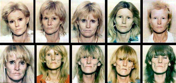 Say NO To Dope!: Drugs will take a toll on your physical appearance